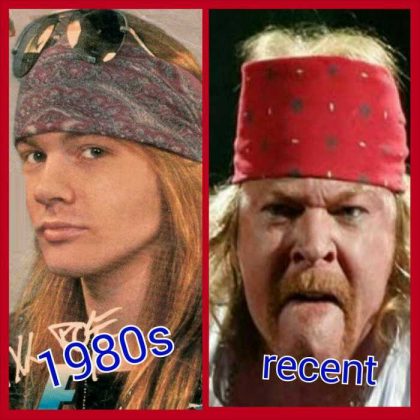 Axl Rose Then And Now Eye-Opening Photos