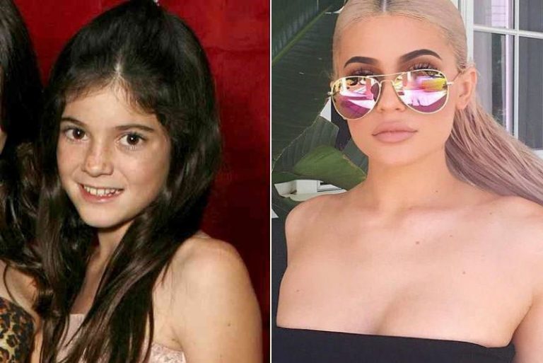 Kylie Jenner Then And Now Stunning Beauty Evolution